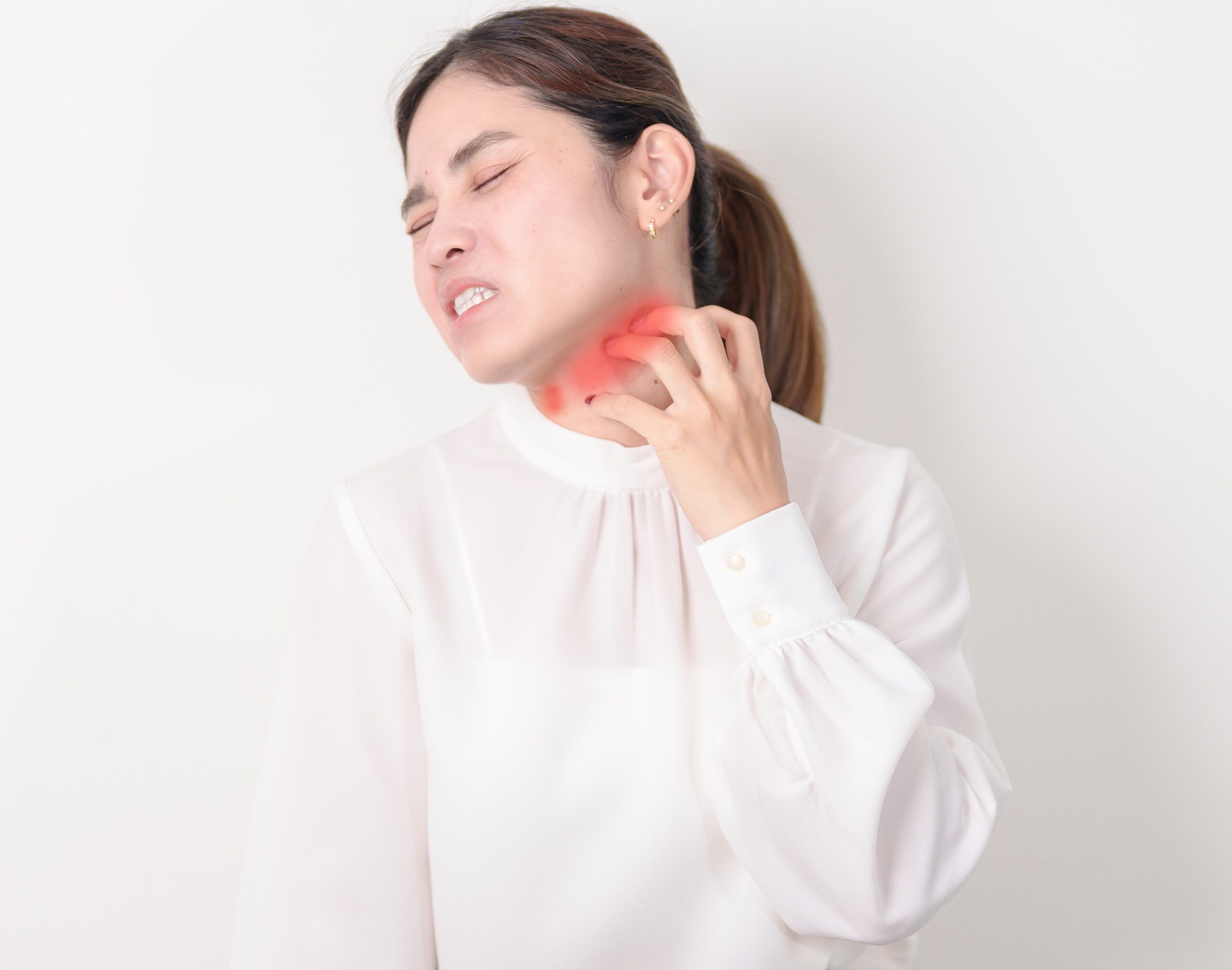 SLE: Warning Signs, Symptoms, Diagnosis, and Treatment