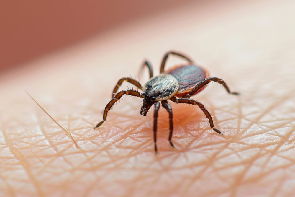Scrub Typhus: The Silent Threat from Chigger Mites & Prevention Guide