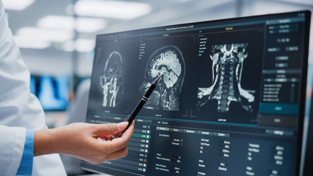 โปรแกรมตรวจคัดกรองโรคหลอดเลือดสมอง Stroke Screening Program