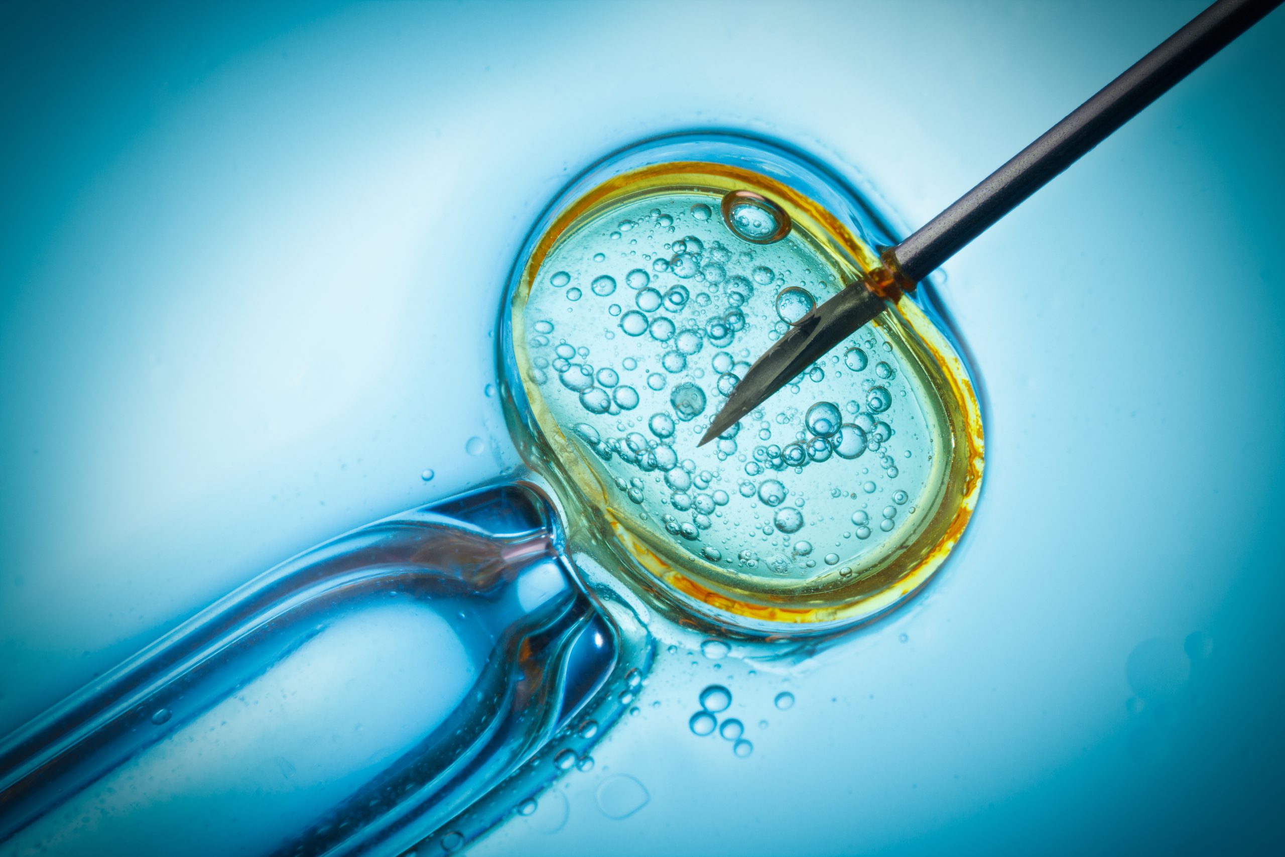  Intracytoplasmic Sperm Injection ICSI 